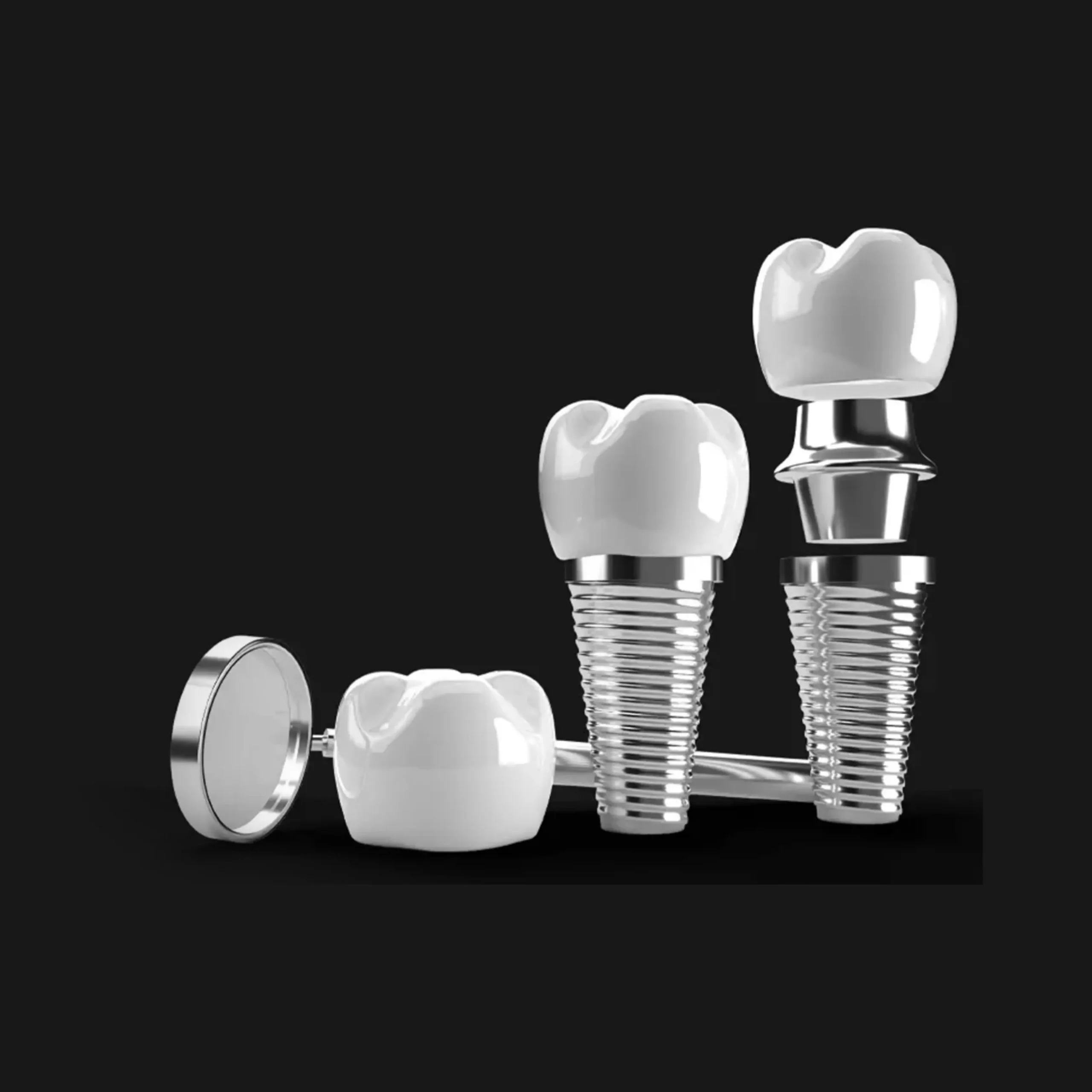 Best Brands for Dental Implants: A Guide to Top Implant Options